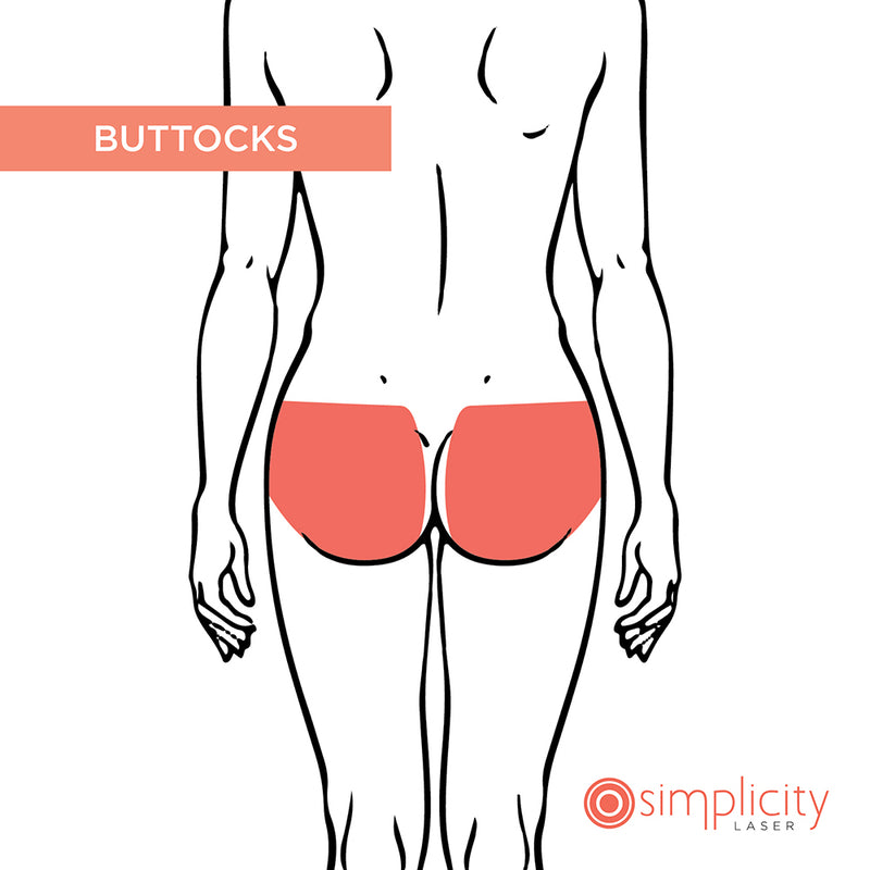 Buttocks Women's 14-Treatment Monthly Program