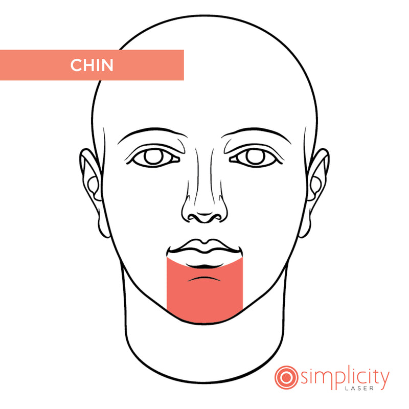 Women’s Laser Chin Hair Removal | Simplicity Laser