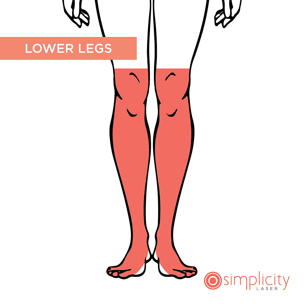 Lower Legs Women's 14-Treatment Monthly Program