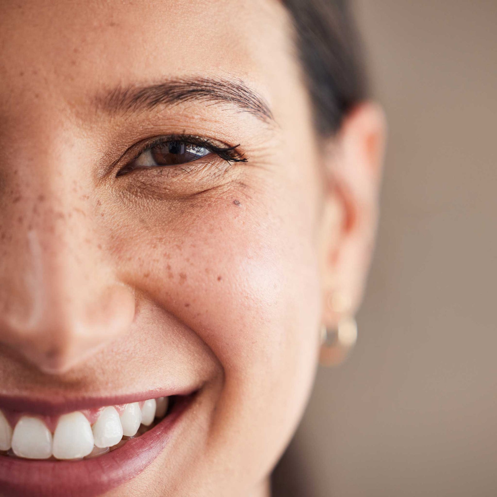 Upper Lip Laser Hair Removal | Simplicity Laser